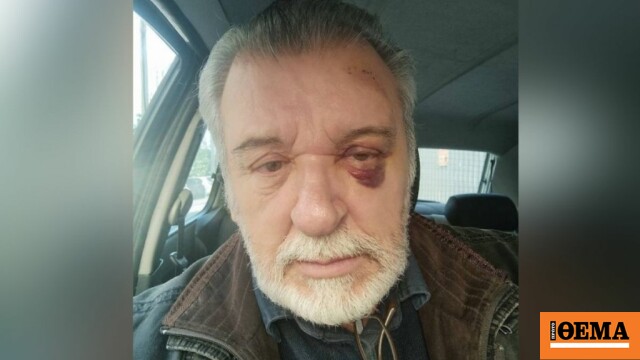 Ατύχημα για τον Τάσο Χαλκιά - «Ένα σοβαρό, επικίνδυνο τραύμα»
