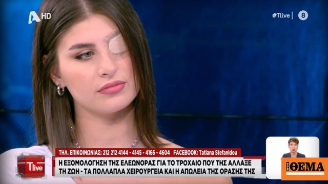 Συγκινεί η 19χρονη που «έχασε» το αριστερό της μάτι σε τροχαίο: «Δεν ...