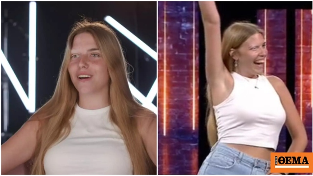 GNTM: Το υποψήφιο μοντέλο με τη λεύκη που κέρδισε τους κριτές